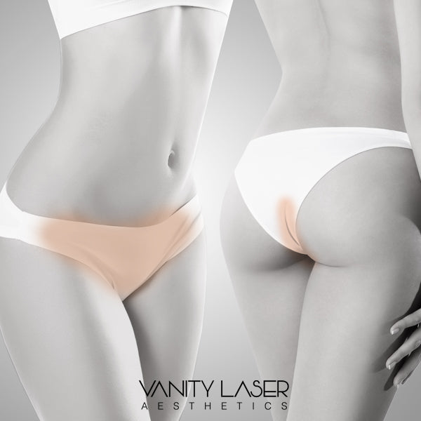 Brazilian – Vanitylaser